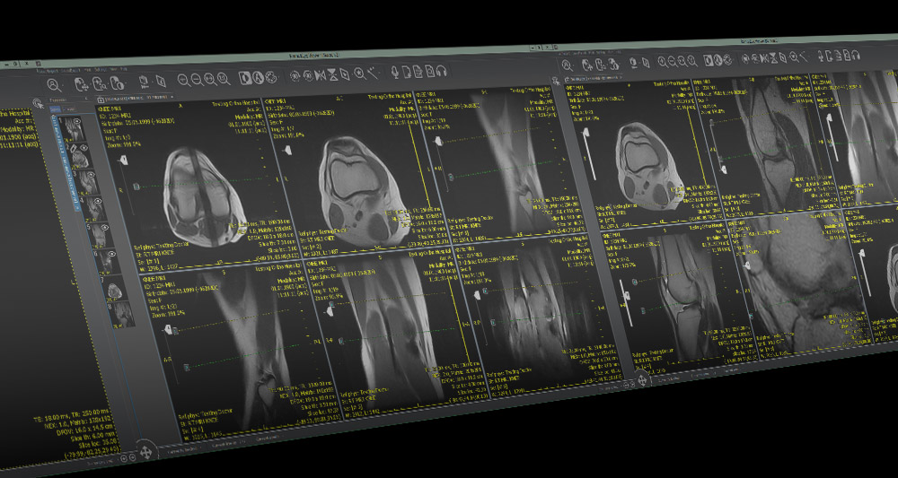 HTML5 Based DICOM Web Viewer | Essential Enterprise Solutions, Inc. EESIPACS